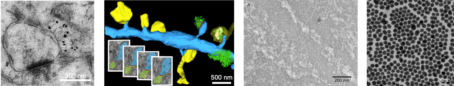 Ultrastructural Electron Microscopy Facility | er-c